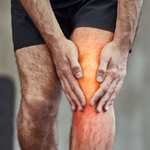 Lesiones de rodilla – Cirugía Articular Quito