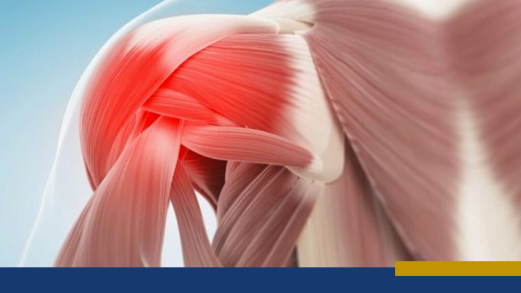 Lesión de Manguito Rotador – Cirugía Articular Quito